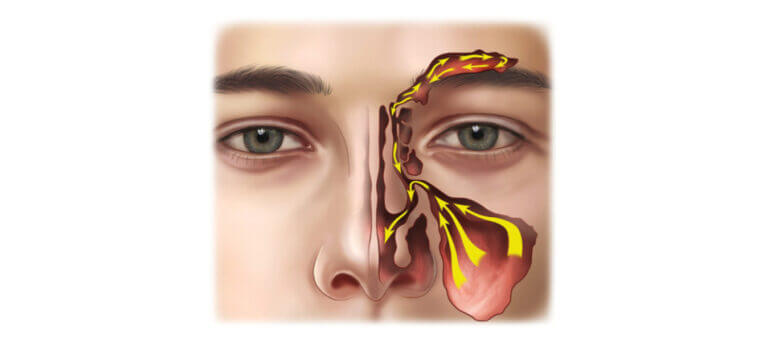 Vi tilbyder - Øre Næse Hals